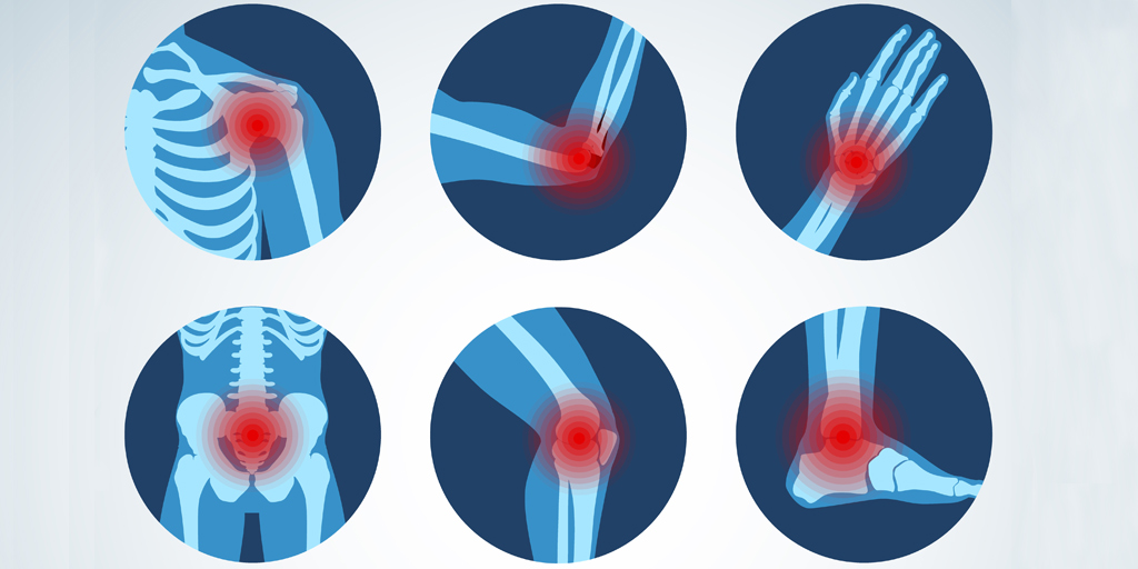 Inflammation | National Institute of Environmental Health Sciences
