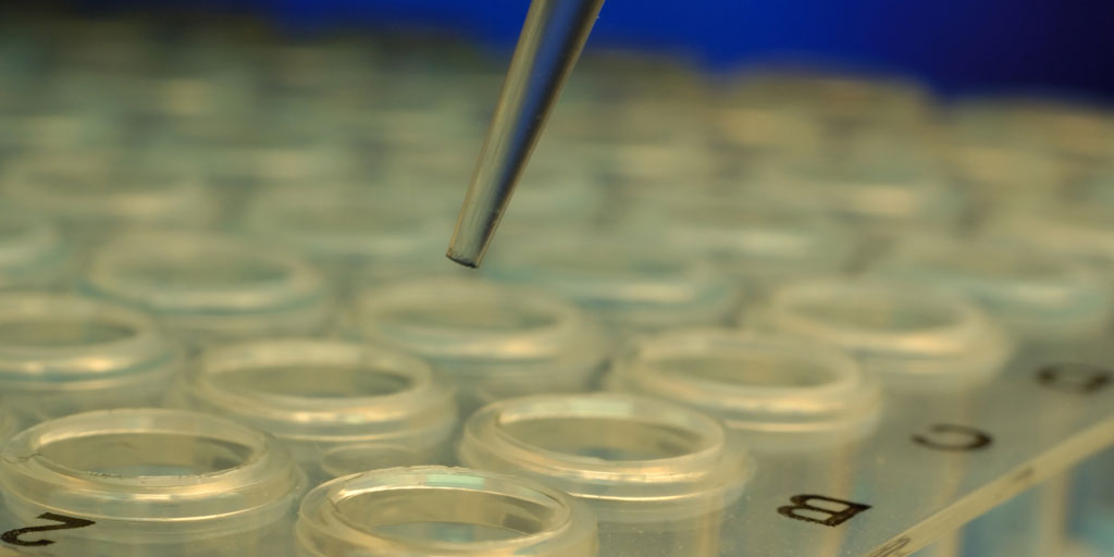 Environmental Health Science Basics | National Institute of ...